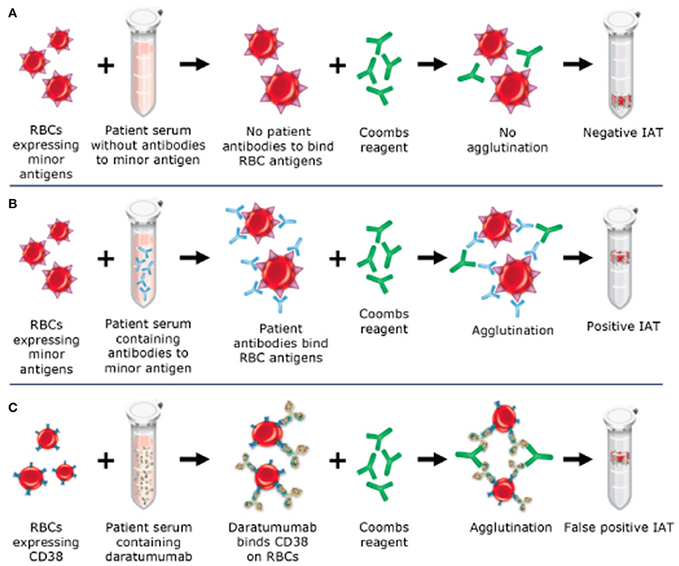 11.01 Antibodies & Blood Groups – BioMed Foundation