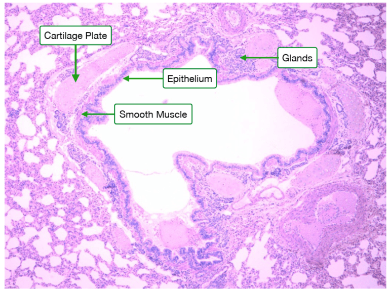 9.03 Trachea, Bronchi, and Bronchioles – BioMed Foundation