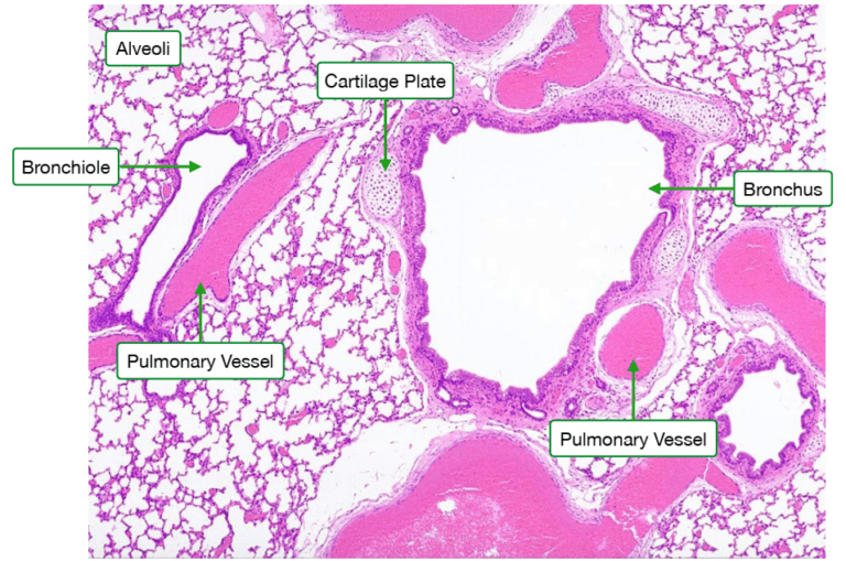 9.03 Trachea, Bronchi, and Bronchioles – BioMed Foundation